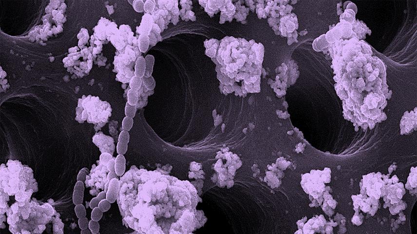 Medical engineering and biomaterials - University of Plymouth