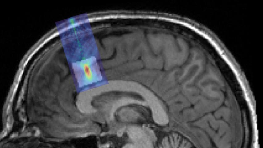 Novel toolbox for planning transcranial ultrasound stimulation studies ...