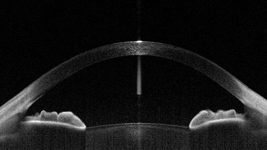 The Ocular Accommodation Research Lab - University of Plymouth