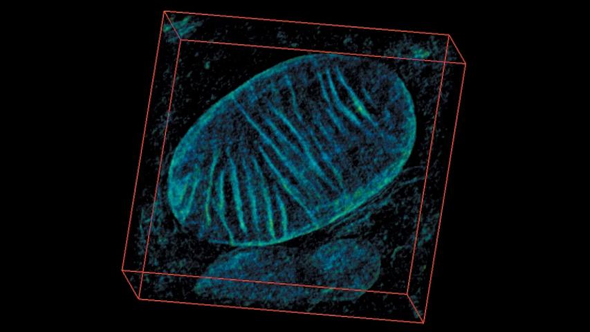 TEM Tomography - University of Plymouth
